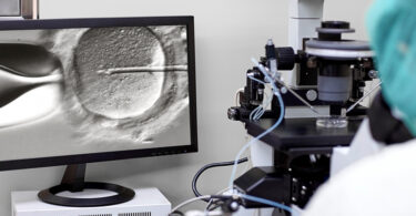 IVF and intracytoplasmic sperm injection (ICSI) | Progyny